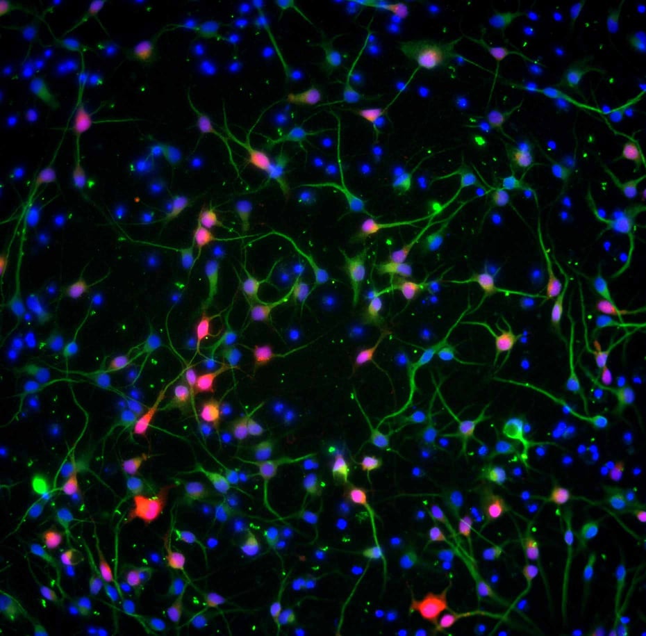 In Vitro Cell & Gene Therapy Assay Services - PhenoVista Biosciences