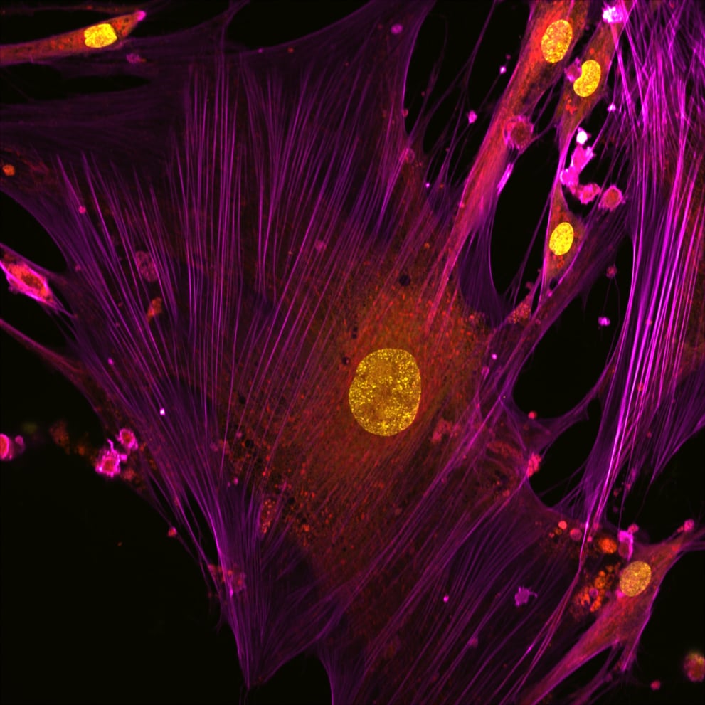 In Vitro Fibrosis Assay Services - PhenoVista Biosciences