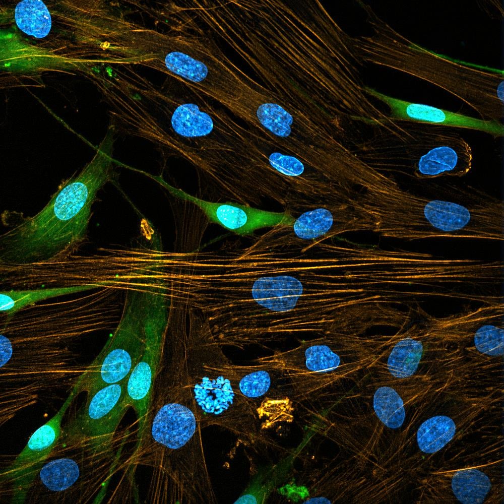 In Vitro Oncology & Immuno-Oncology Assay Services - PhenoVista