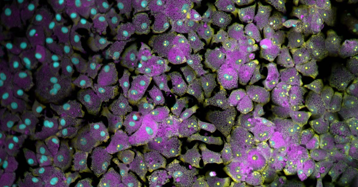 Cell Painting Assay Services - Drug Discovery