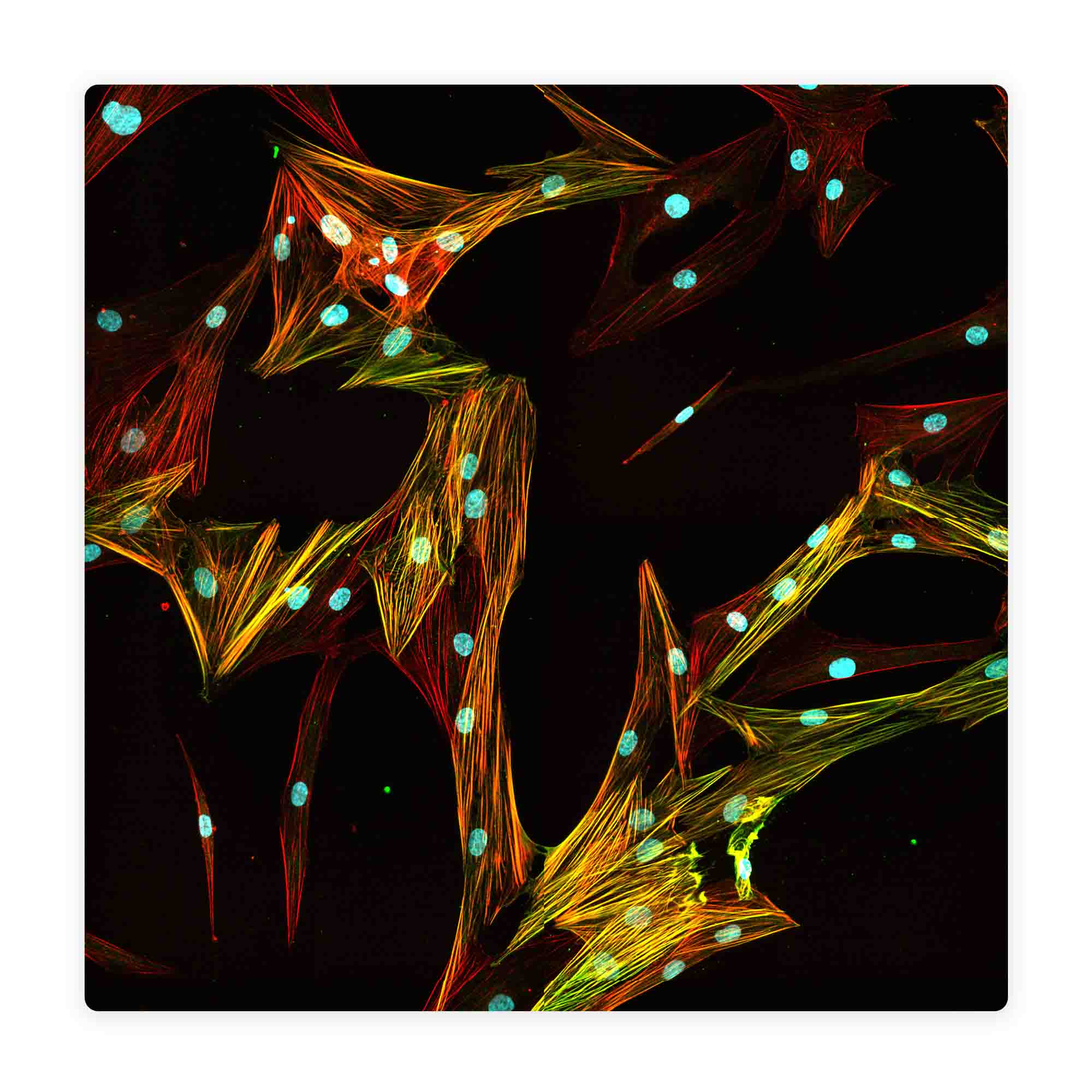 In Vitro Fibrosis Assay Services - PhenoVista Biosciences