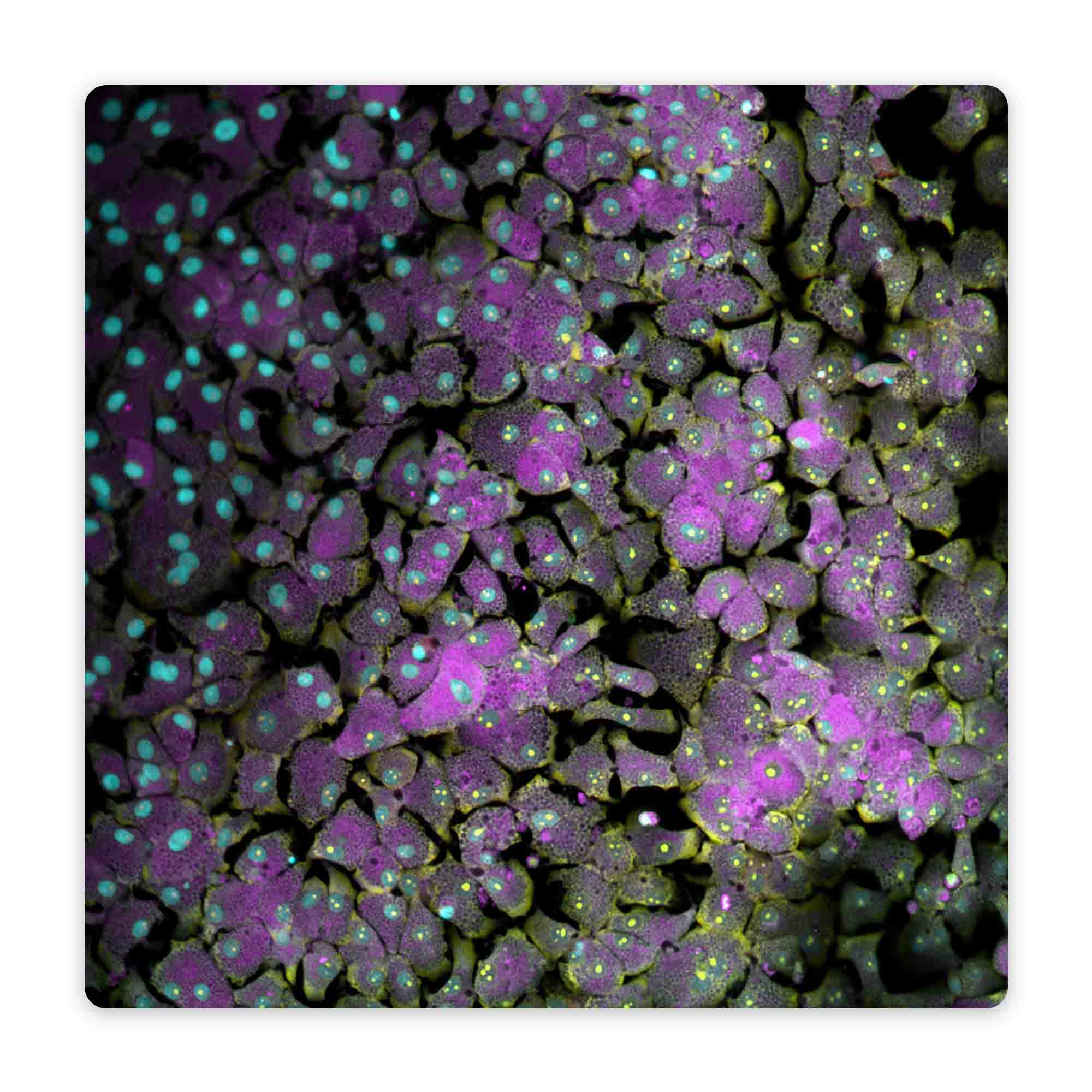 Cell Painting Assay Services - Drug Discovery