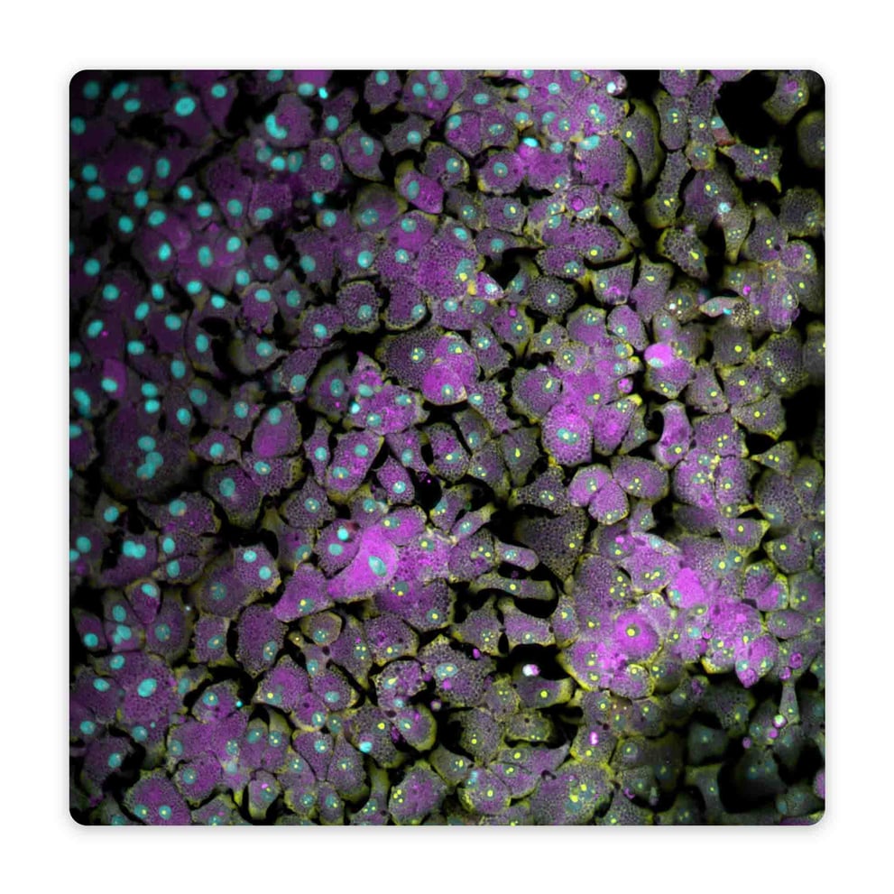 Cell Painting Assay Services - Drug Discovery