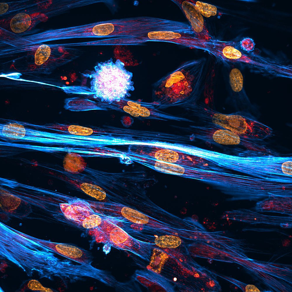 In Vitro Oncology & Immuno-Oncology Assay Services - PhenoVista