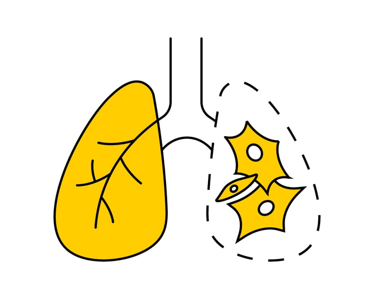 Ready-2-Go (R2G) Assay Services - PhenoVista Biosciences