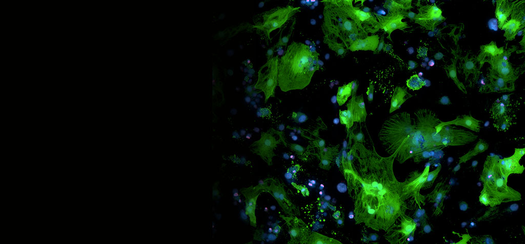 Evaluating Transduction Efficiencies of AAV Vectors into Human iPSC ...