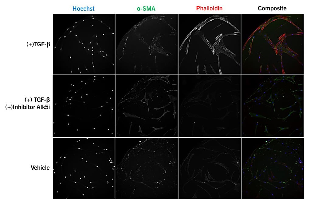 R2G Lung Fibrosis Assay Services