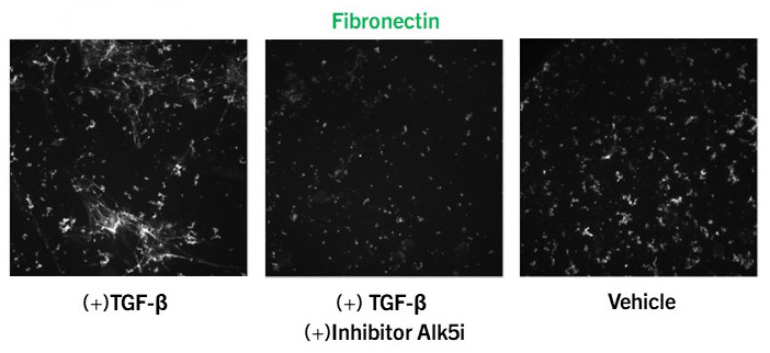 R2G Lung Fibrosis Assay Services