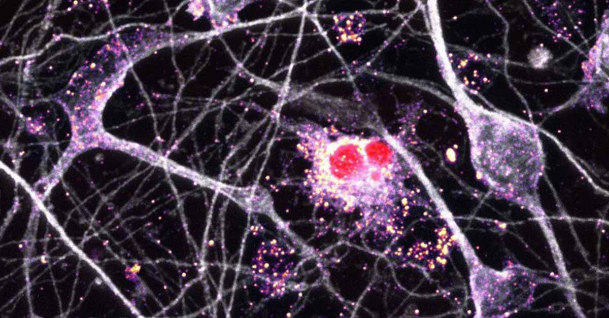 In Vitro Neurobiology Assay Services - PhenoVista Biosciences