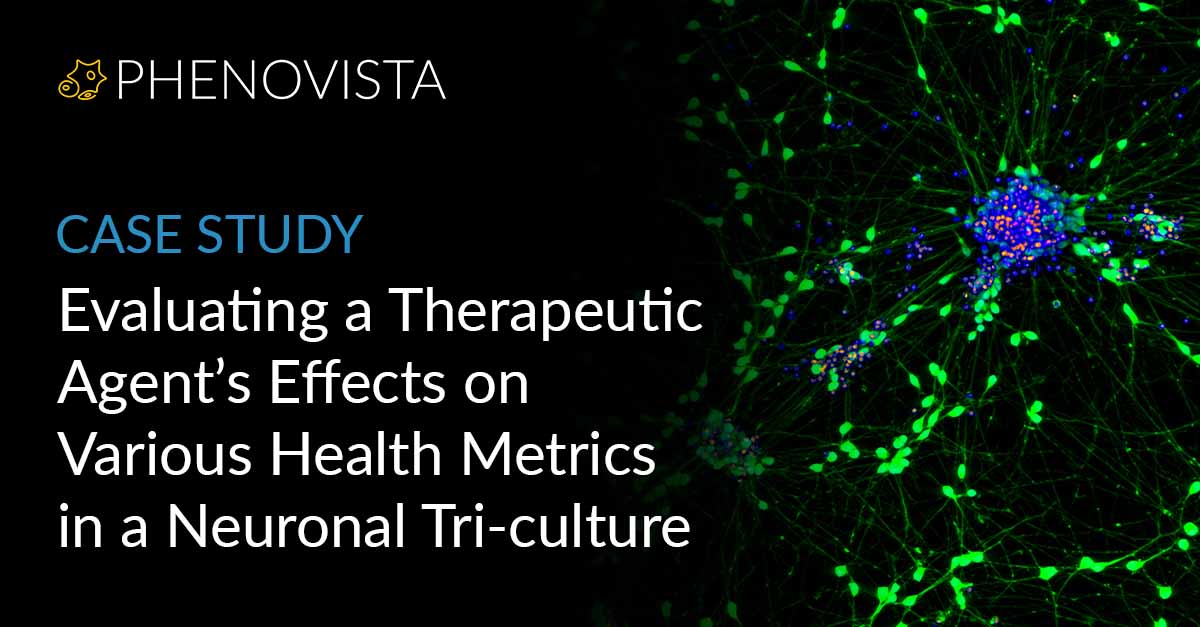 Compound-activity Profiling in iPSC-derived Sensory Neurons via FLIPR