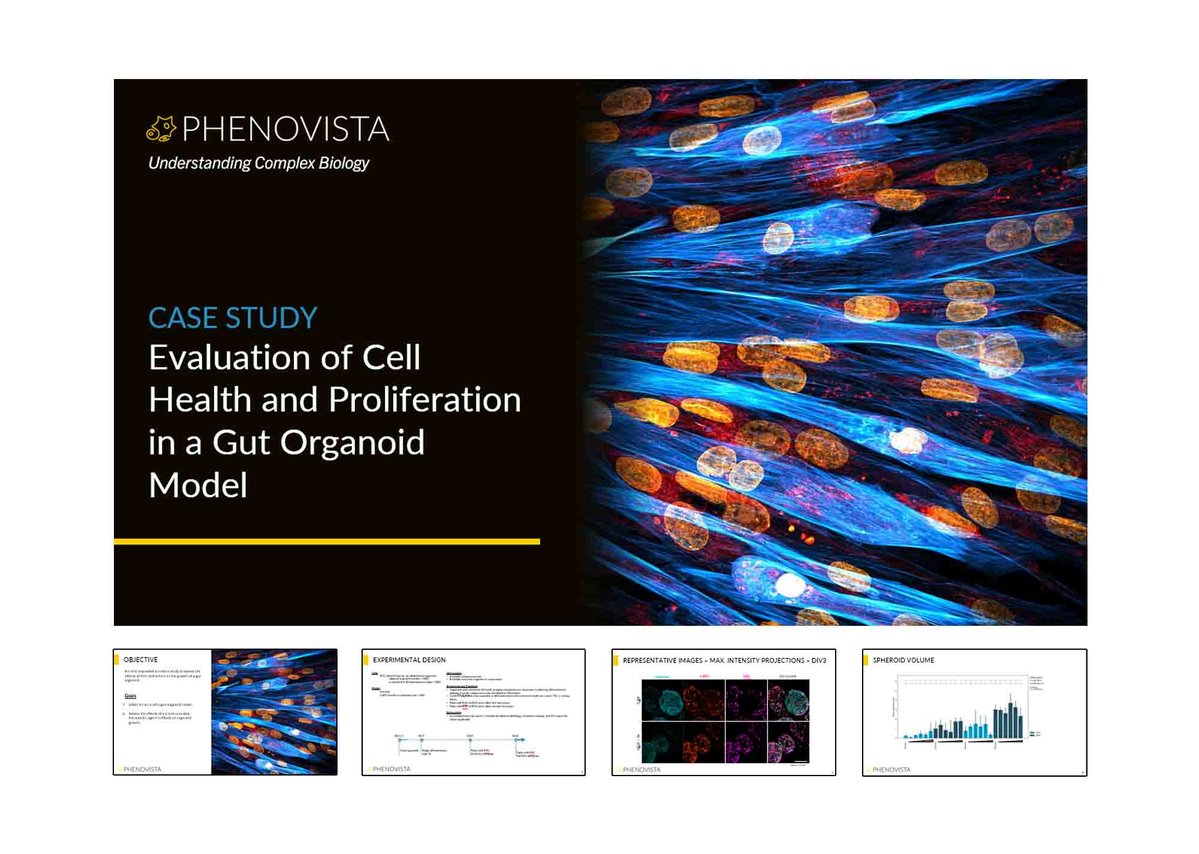 Evaluation of Cell Health & Proliferation in a Gut Organoid Model Case ...