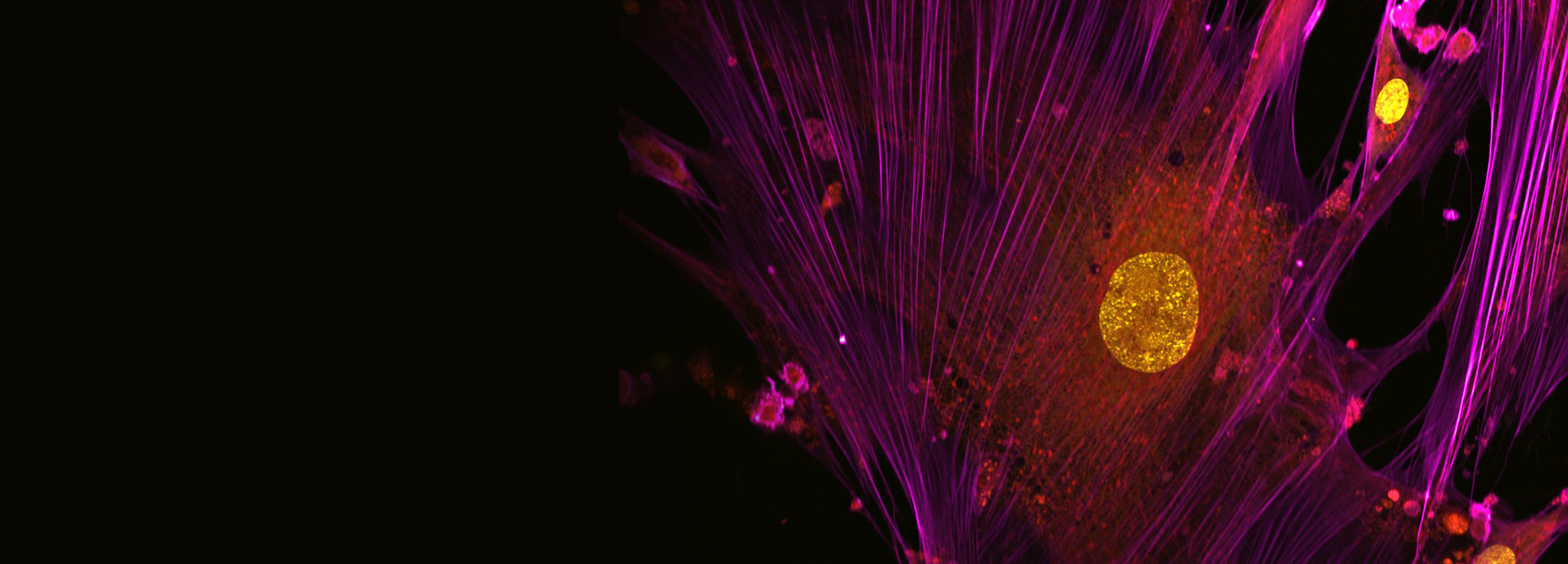 R2G Lung Fibrosis Assay Services