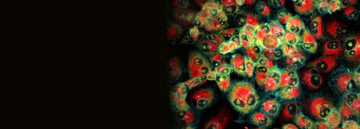 Cell Painting Assay Services - Drug Discovery