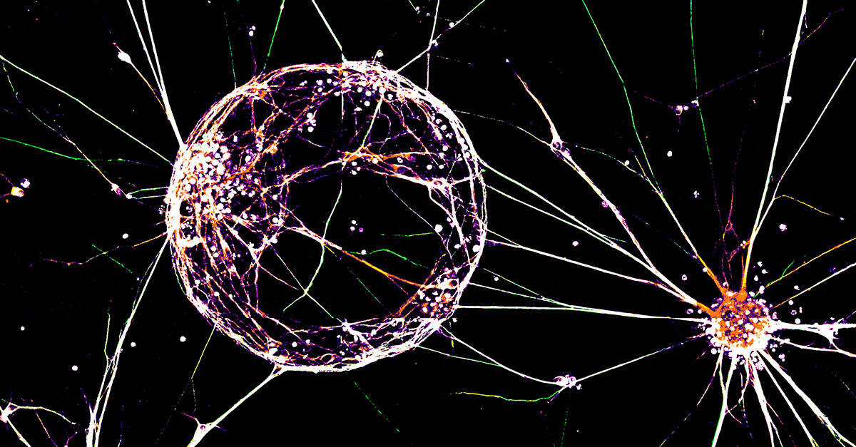 In Vitro Neurobiology Assay Services - PhenoVista Biosciences