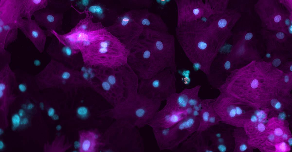 Advancing Gene Delivery with Dual-AAV Therapy
