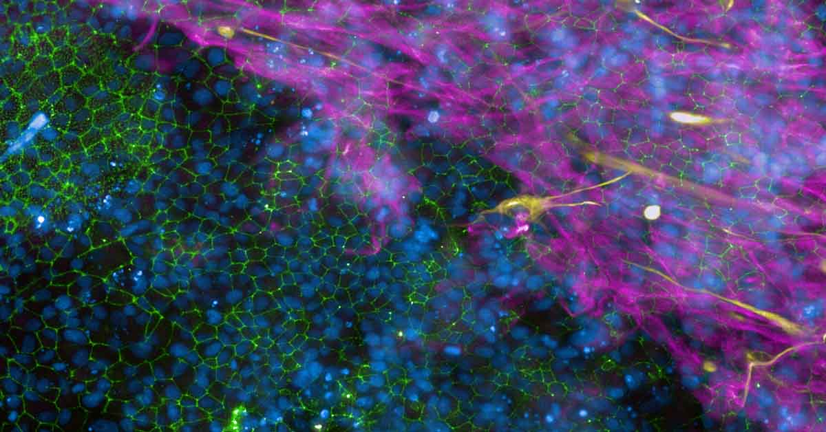 Unique Benefits of Using High-content Imaging in Non-clinical R&D