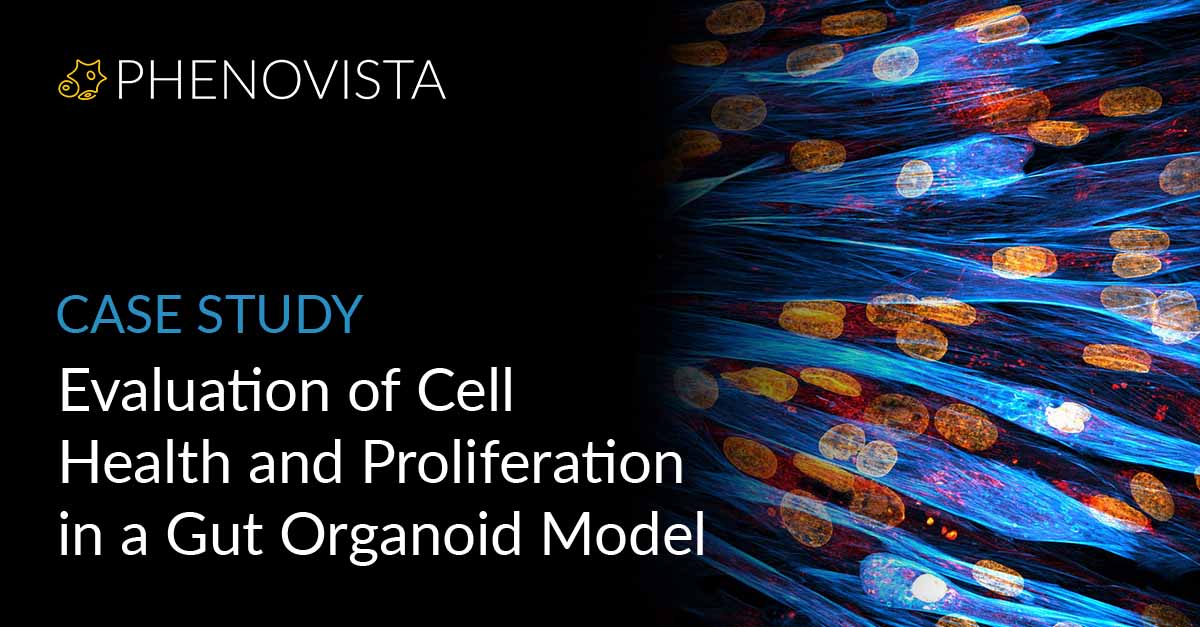 Evaluation of Cell Health & Proliferation in a Gut Organoid Model Case ...